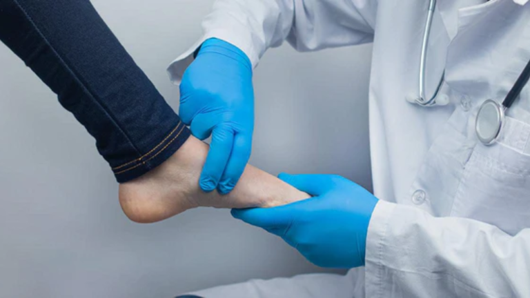 Role Of Insoles In Managing Plantar Fasciitis - Sole Savior